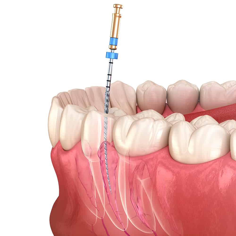 Robinhood Dental Practice
